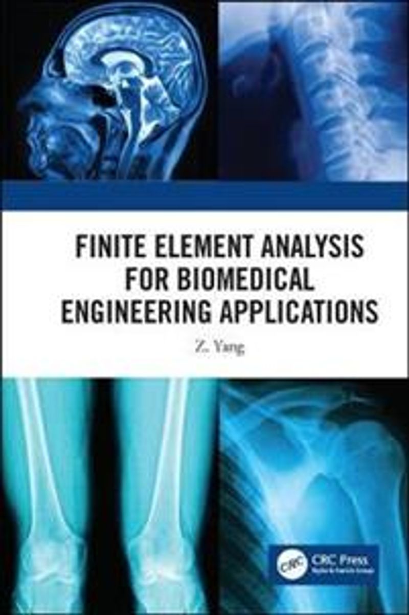 Finite Element Analysis for Biomedical Engineering Applications på ... Finite Element Analysis for Biomedical Engineering Applications på ...